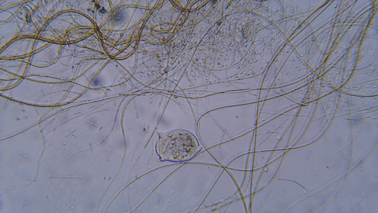 Brachionus Sp. - YouTube