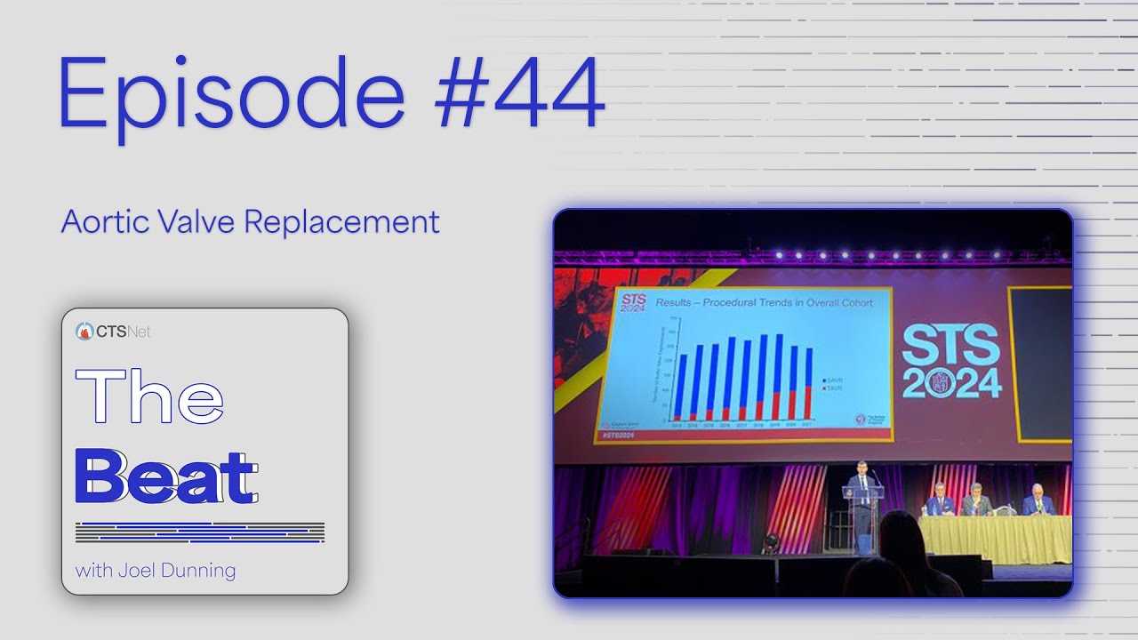 The Beat with Joel Dunning Ep. 44 - YouTube