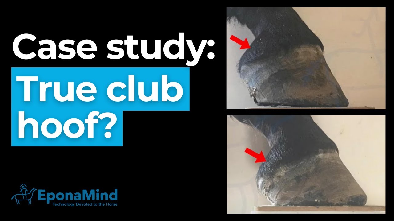 Case Study: A True Club Hoof or a High Walled Hoof? - YouTube