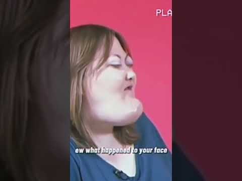 Ew what happened to your face - YouTube