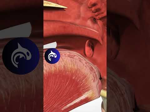 What Happens If You Test Positive For Strep Throat