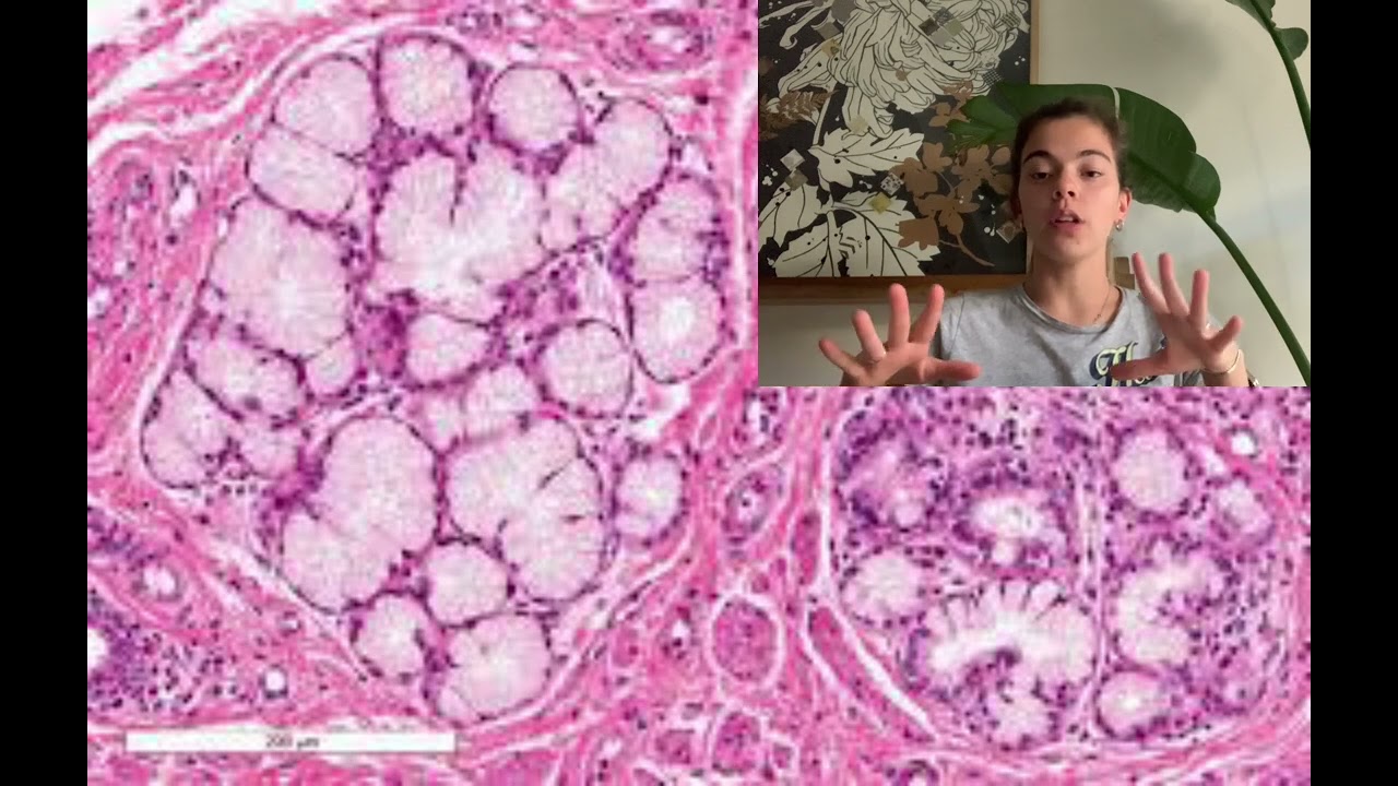 Glándulas acinos, serosas, mucosas y mixtas: 1er parcial Histología ...