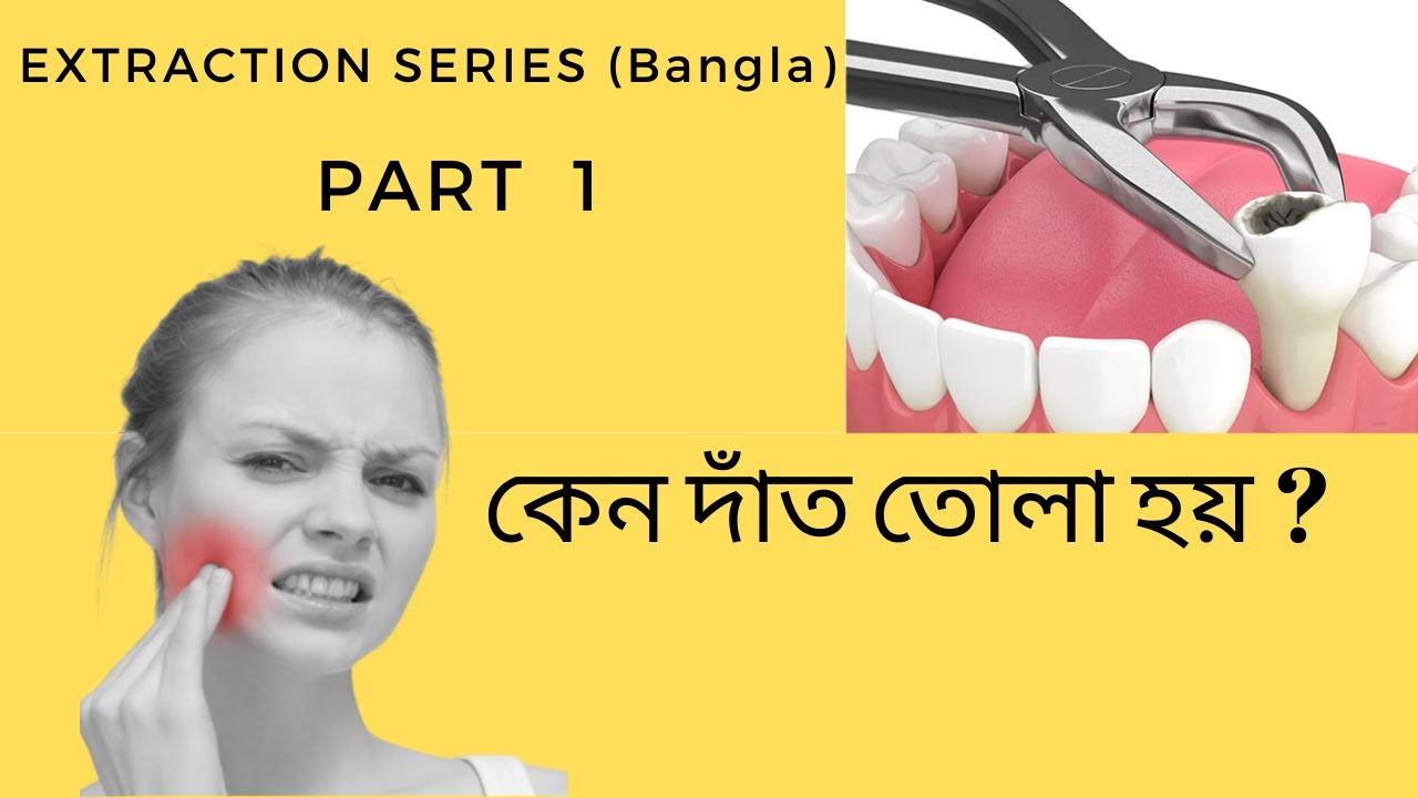কেন দাঁত তোলা হয় ? ! | Extraction Part 1 | 🦷🦷 #দাঁতের_যত্ন #দাঁত - YouTube
