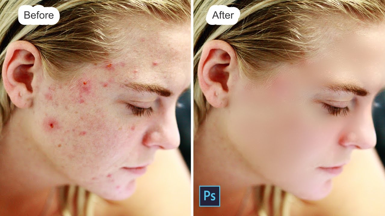 Face Retouching - How to smooth face skin in photoshop | Professional ...