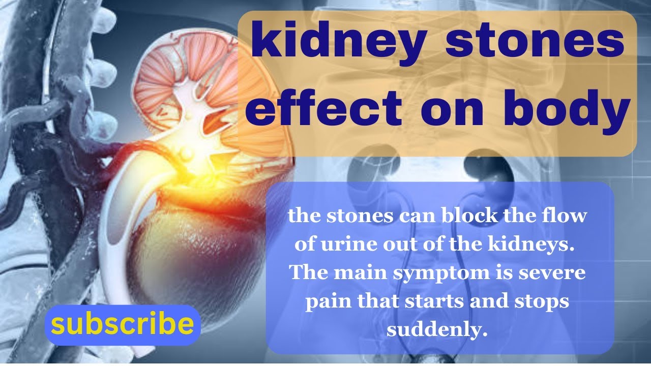 kidney stones effect on body I Karimnagar ivf hospital I Healthcare ...