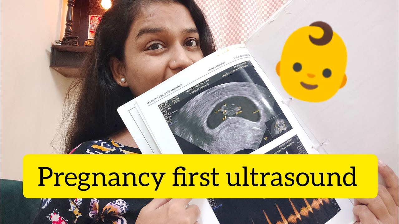 first ultrasound / early scan #pregnancy #baby #youtube - YouTube