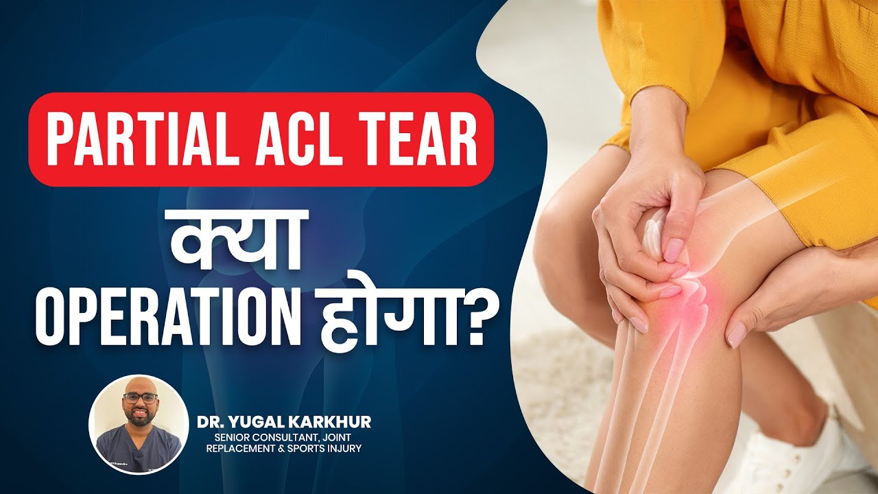 Partial ACL Tear का इलाज | Partial ACL Tear: Operation की ज़रूरत कब ...