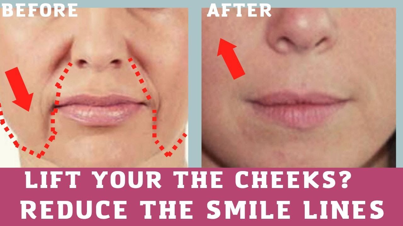 How to lift the cheeks? | Nasolabial Folds | Cheek lift exercises - YouTube