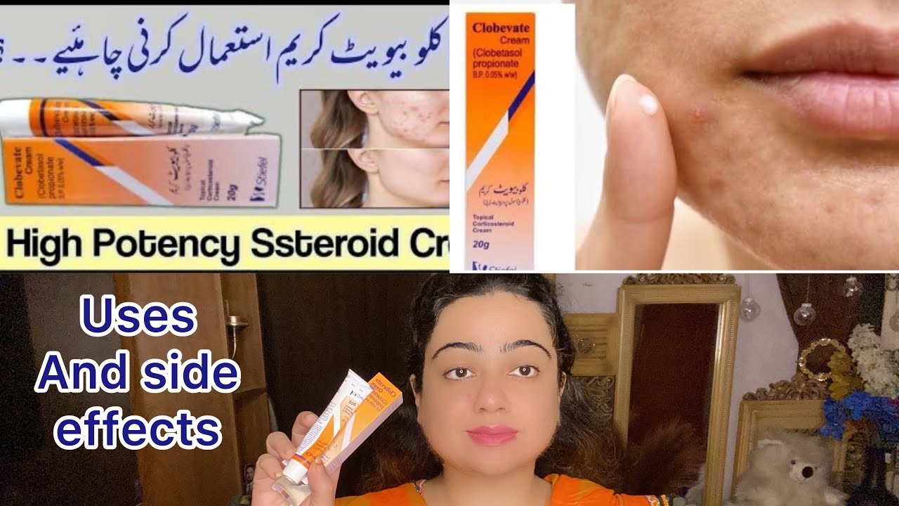 Clobivate Cream Uses For Acne |And Hand whitening |clobetasol For ...