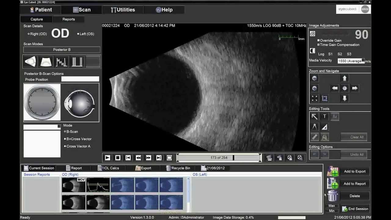 Exporting and Archiving with the Ellex Eye Cubed - YouTube