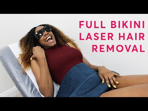 FULL Bikini and Perianal - Laser Hair Removal (Live Treatment)