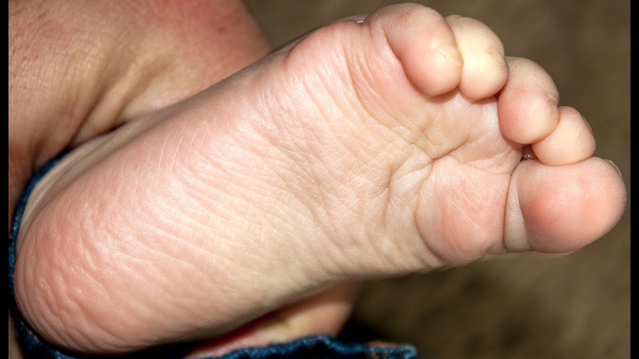 Can't be Mad With Feet In Your Face! - YouTube