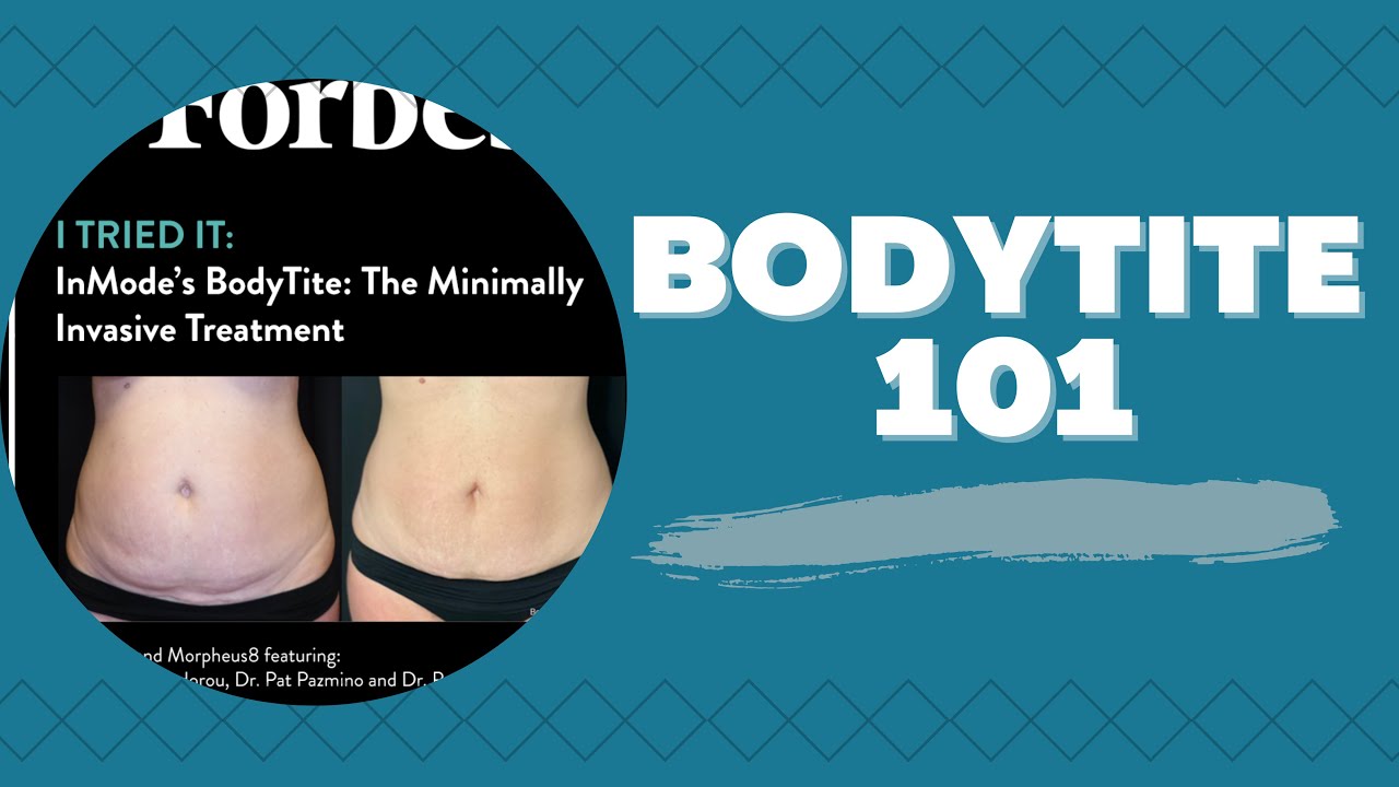 BodyTite 101 - YouTube