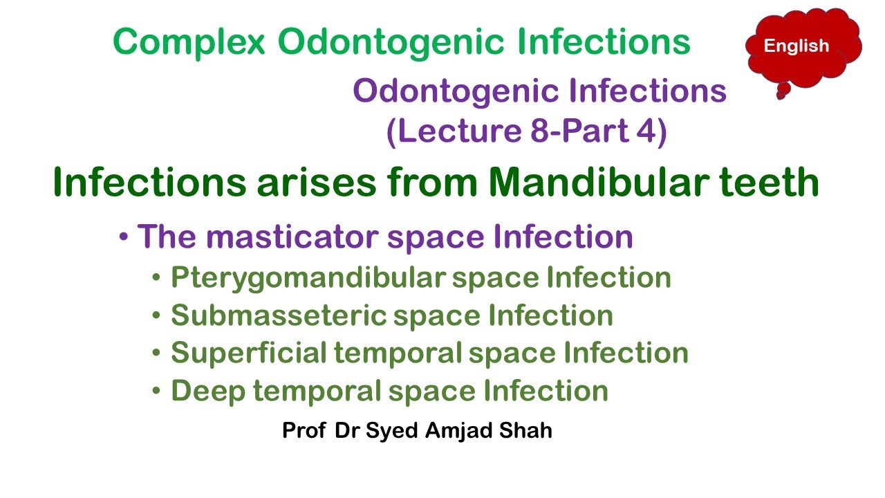 Masticator space | Pterygomandibular | Submasseteric | Superficial ...