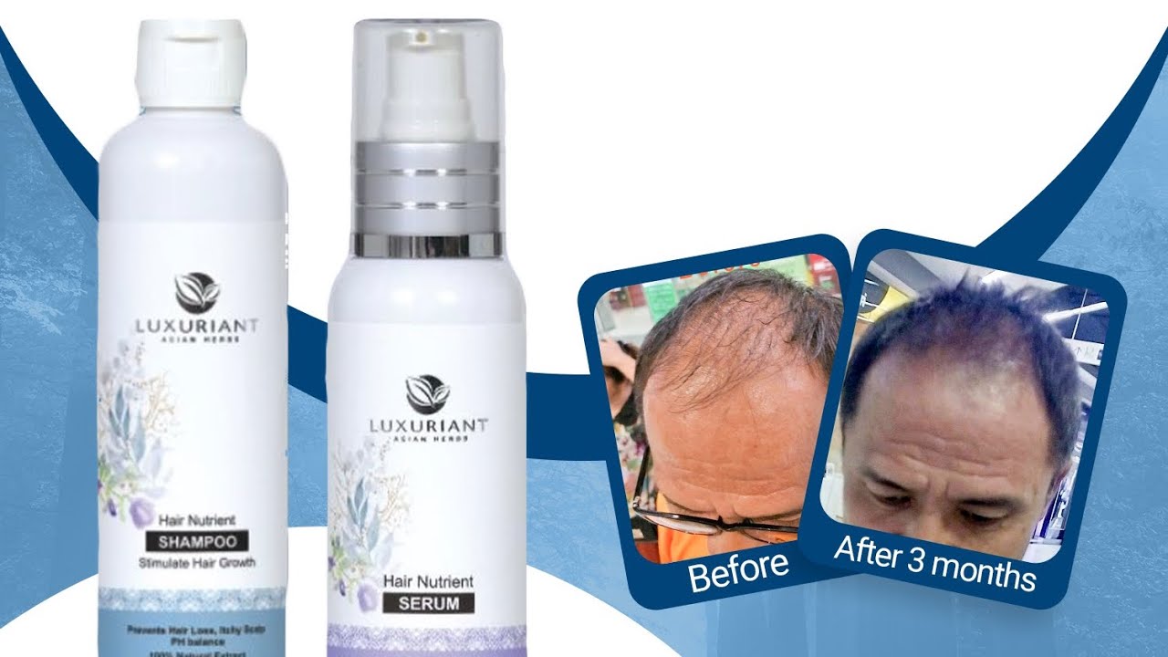 Luxuriant Natural Products Encourages Hair Growth Prevents Hair Loss Luxuriant Natural Products Encourages Hair Growth Prevents Hair Loss