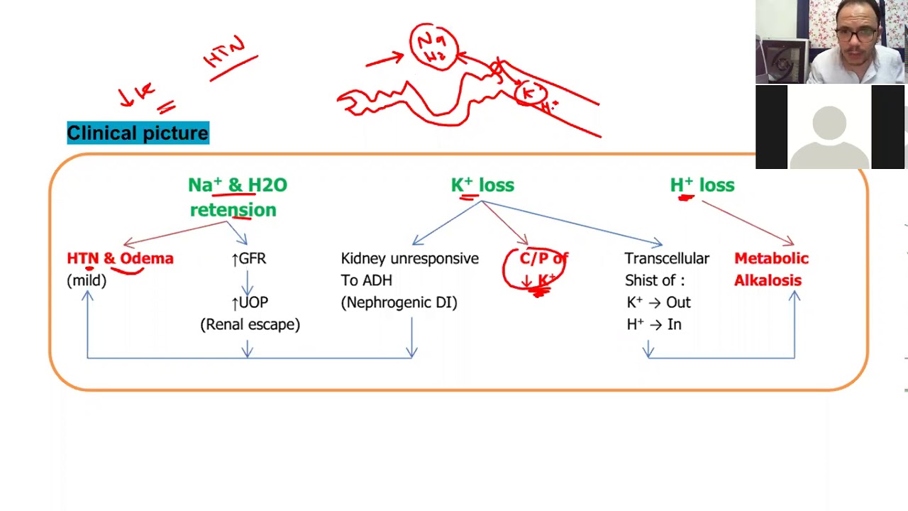 Endo 7 Conn's and Cushing 1 - YouTube