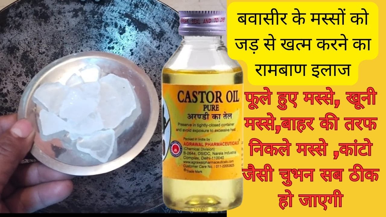 Bavasir ka ilaaj ,elaaj bavasir ki dawai, bavasir ke masse बवासीर के ...