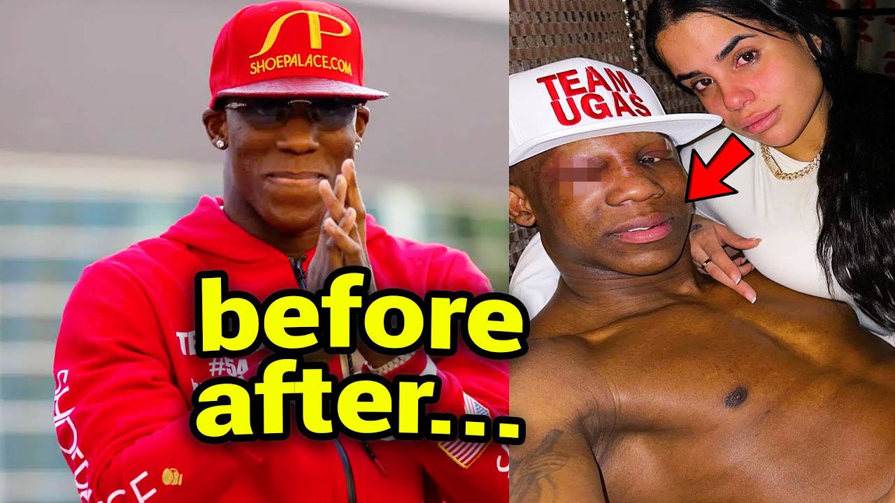 EGO INJURY REPORT: Yordenis Ugas EYE DAMAGED From Errol Spence Then ...