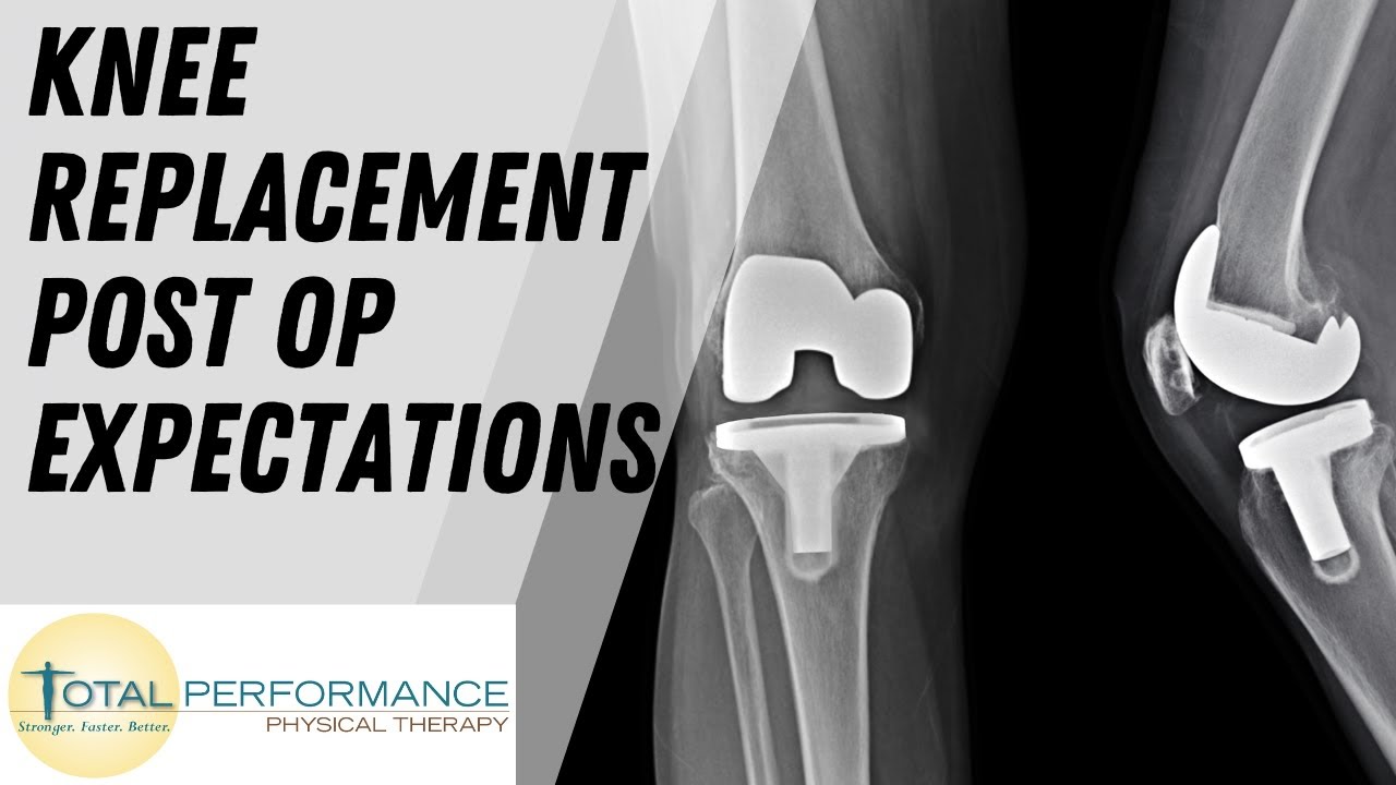 Knee replacement post op expectations - YouTube
