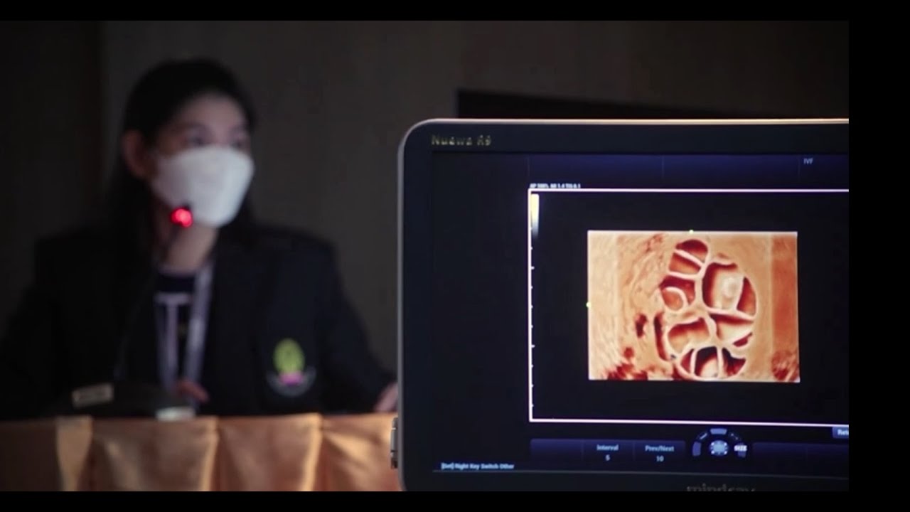 Mindray Mediplex Ultrasound School - Chula mmed SonoSchool - YouTube