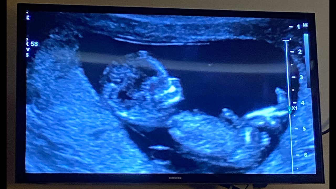 Boy Or Girl? Ellis Baby Gender Reveal 2023 - YouTube