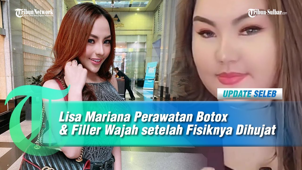 Lisa Mariana Perawatan Botox & Filler Wajah setelah Fisiknya Dihujat ...