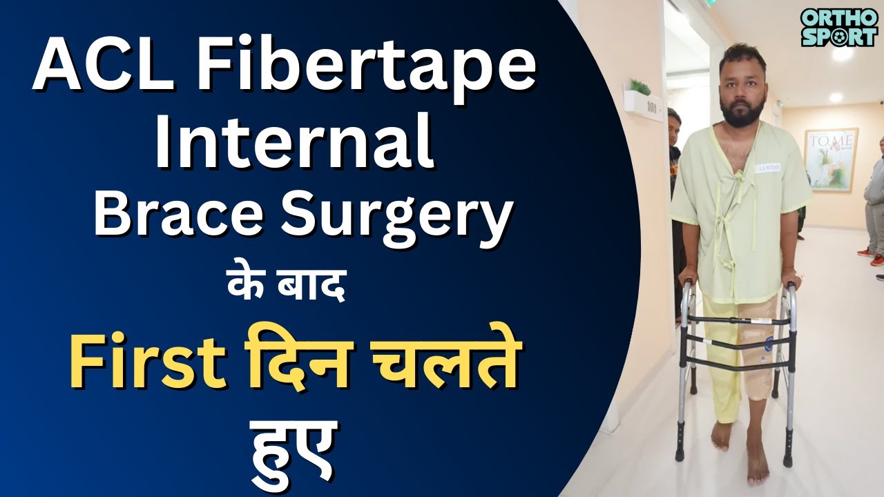 ACL Fibertape Internal Brace Surgery के बाद पाहिले दिन चलते हुए - YouTube