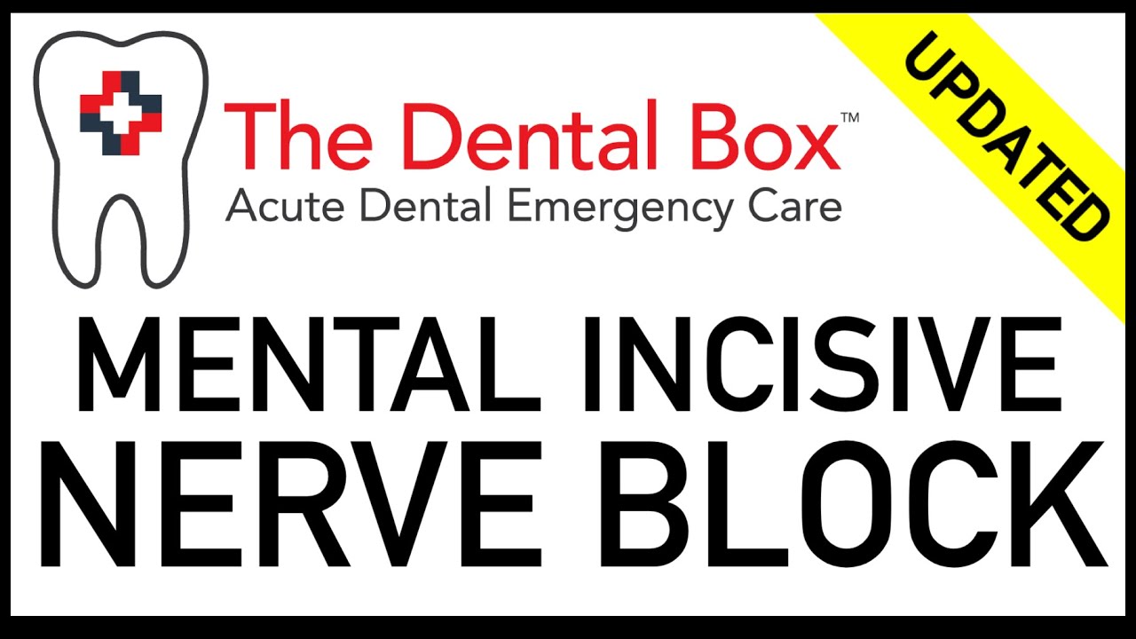 Mental Incisive Nerve Block - YouTube