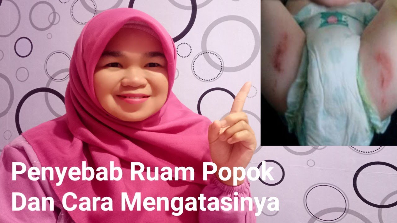 Penyebab Ruam Popok Dan Cara Mengatasinya - YouTube