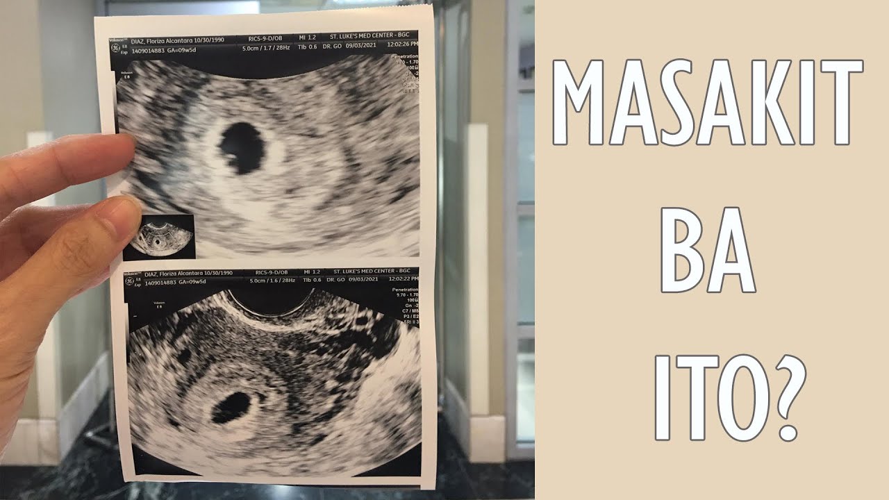 TRANSVAGINAL ULTRASOUND | Step by step process of TRANSVAGINAL ...