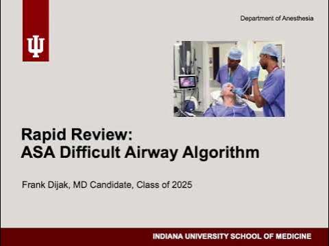 Rapid Review: ASA Difficult Airway Algorithm by Frank Dijak, MD ...
