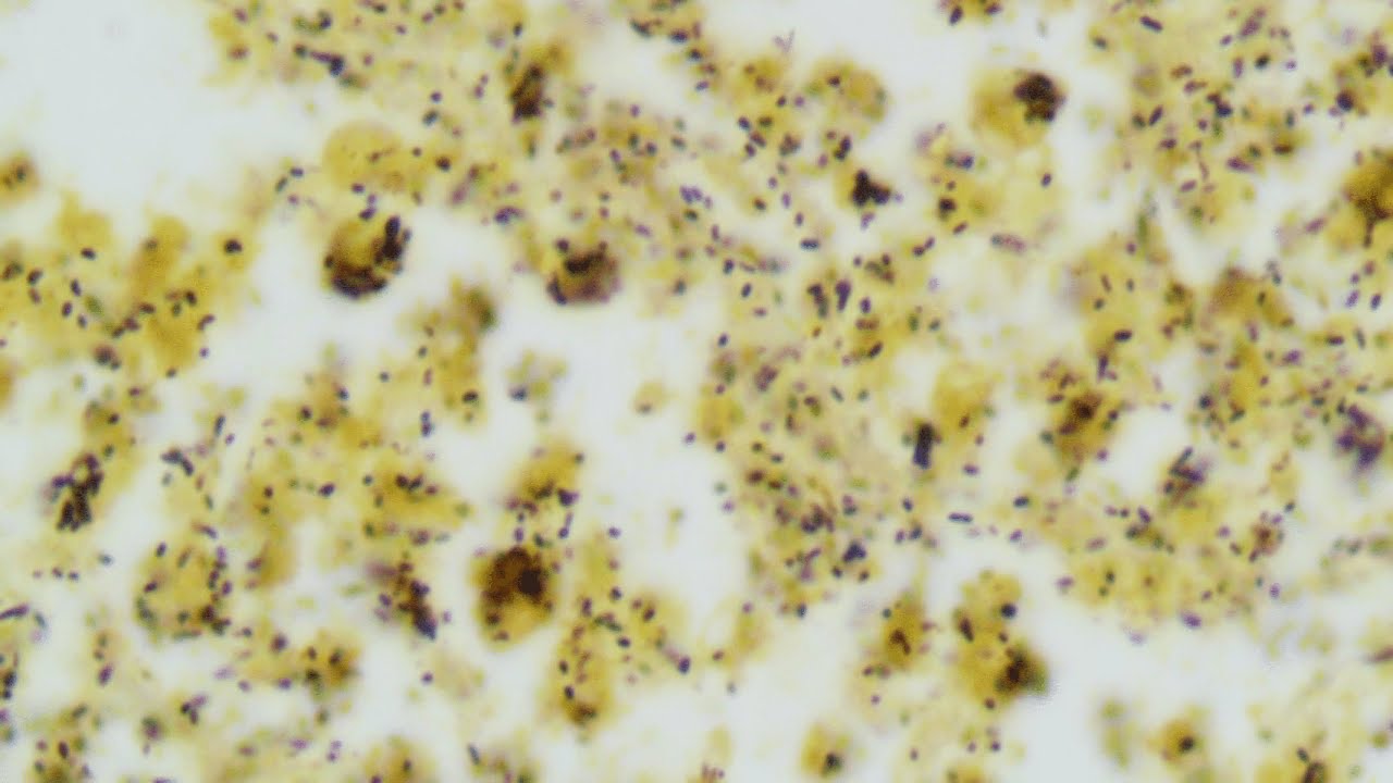 Legionella under the microscope with Dieterle stain - YouTube