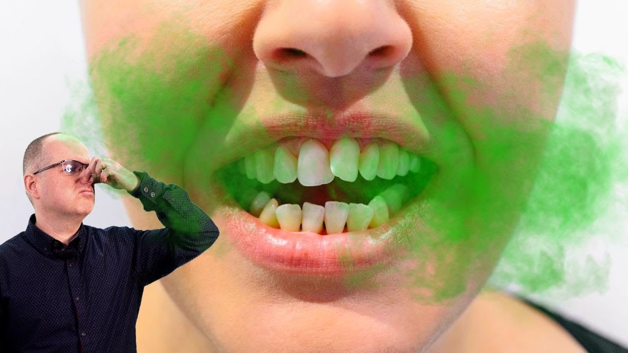 STOP respiraţie urât mirositoare! (halitoza/halena) APLICĂ tratamentul ...