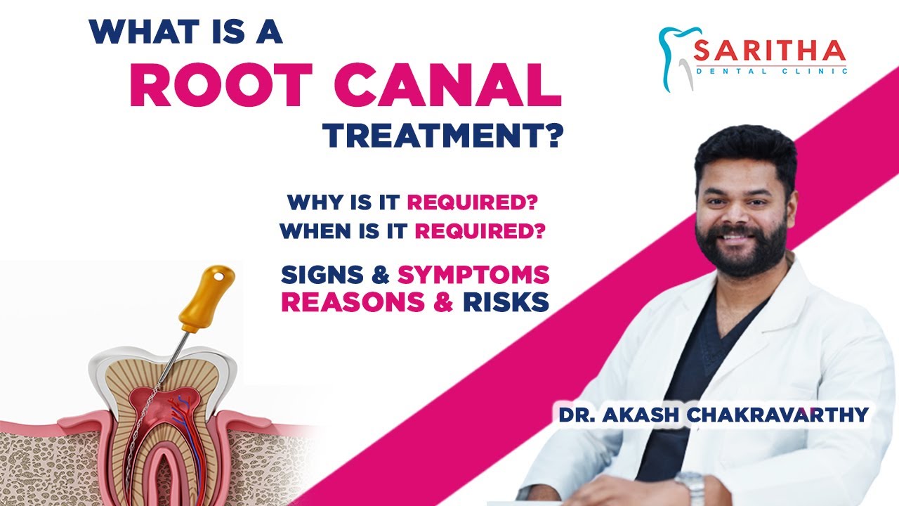 What Is A Root Canal Treatment Symptoms Risks By Dr Akash What Is A Root Canal Treatment Symptoms Risks By Dr Akash