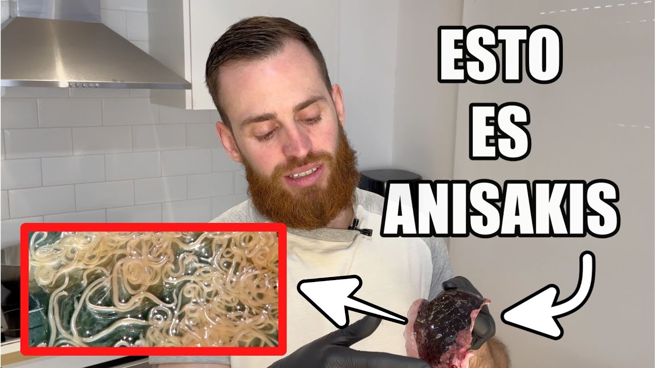 Anisakis: Como Identificarlo Y Preparar El Pescado Para No Cogerlo ...