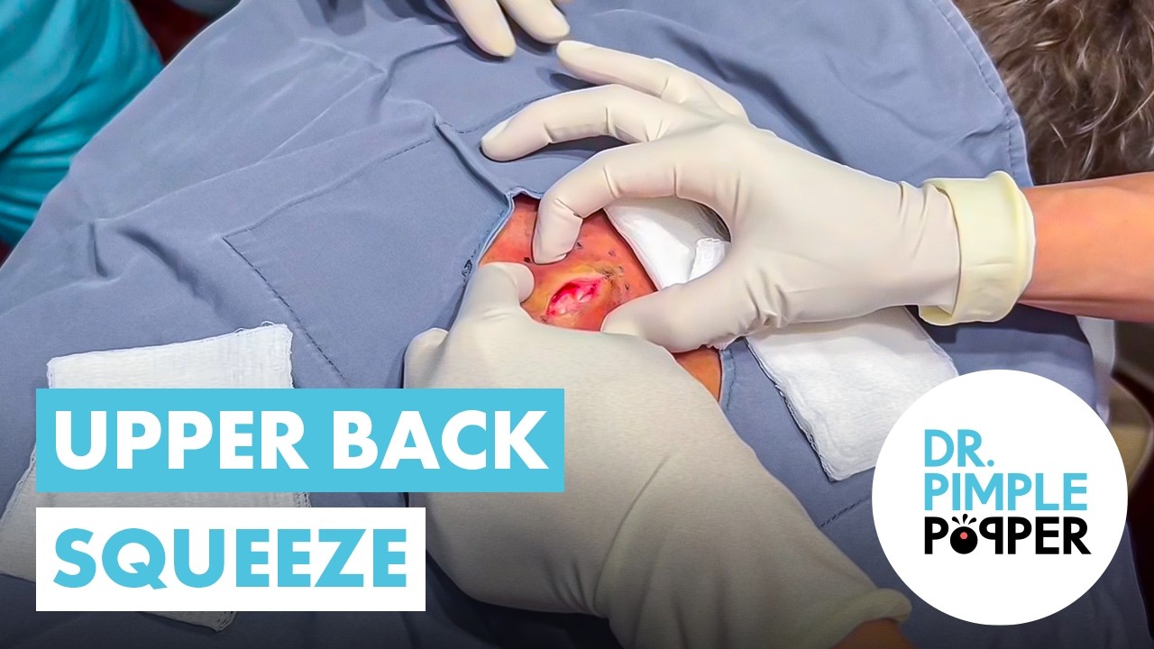 Upper Back Squeeze - YouTube