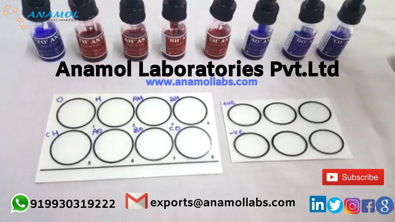Widal Test Procedure Widal 8x5ml Test In English YouTube