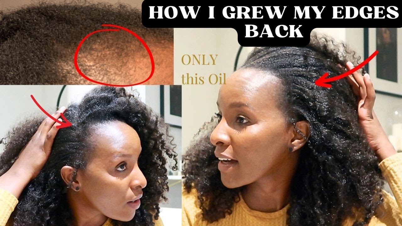 HOW TO GROW EDGES BACK WITH ONLY ONE POWERFUL OIL | How to grow bald ...