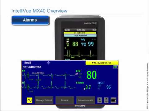 Philips IntelliVue MX40 Patient Monitor - Alarms - YouTube