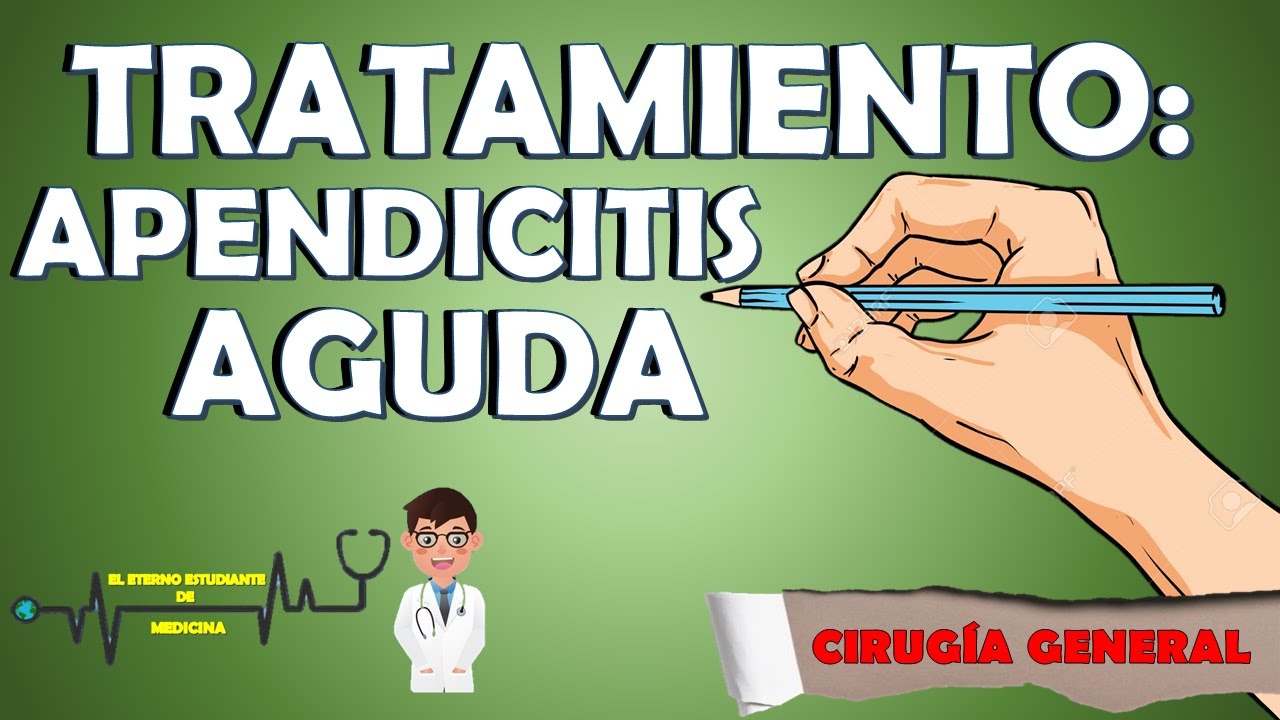 TRATAMIENTO DE LA APENDICITIS AGUDA RESUMEN 📝🔥|En Niños|En Adultos|En ...