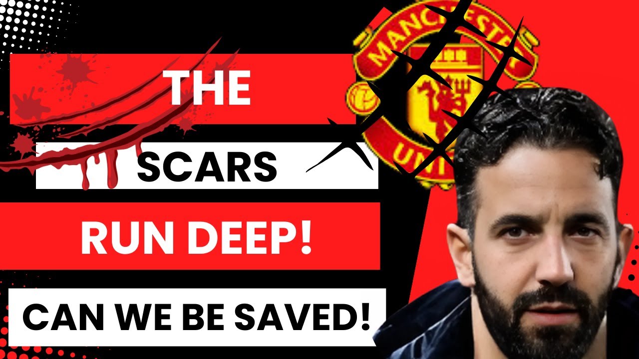 The Scars Run Deep The Latest Manchester United News and Transfer News ...