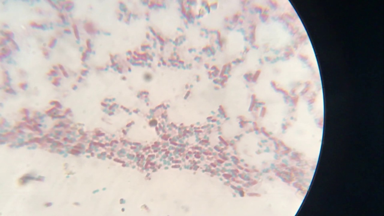 Endospore (under microscope) - YouTube