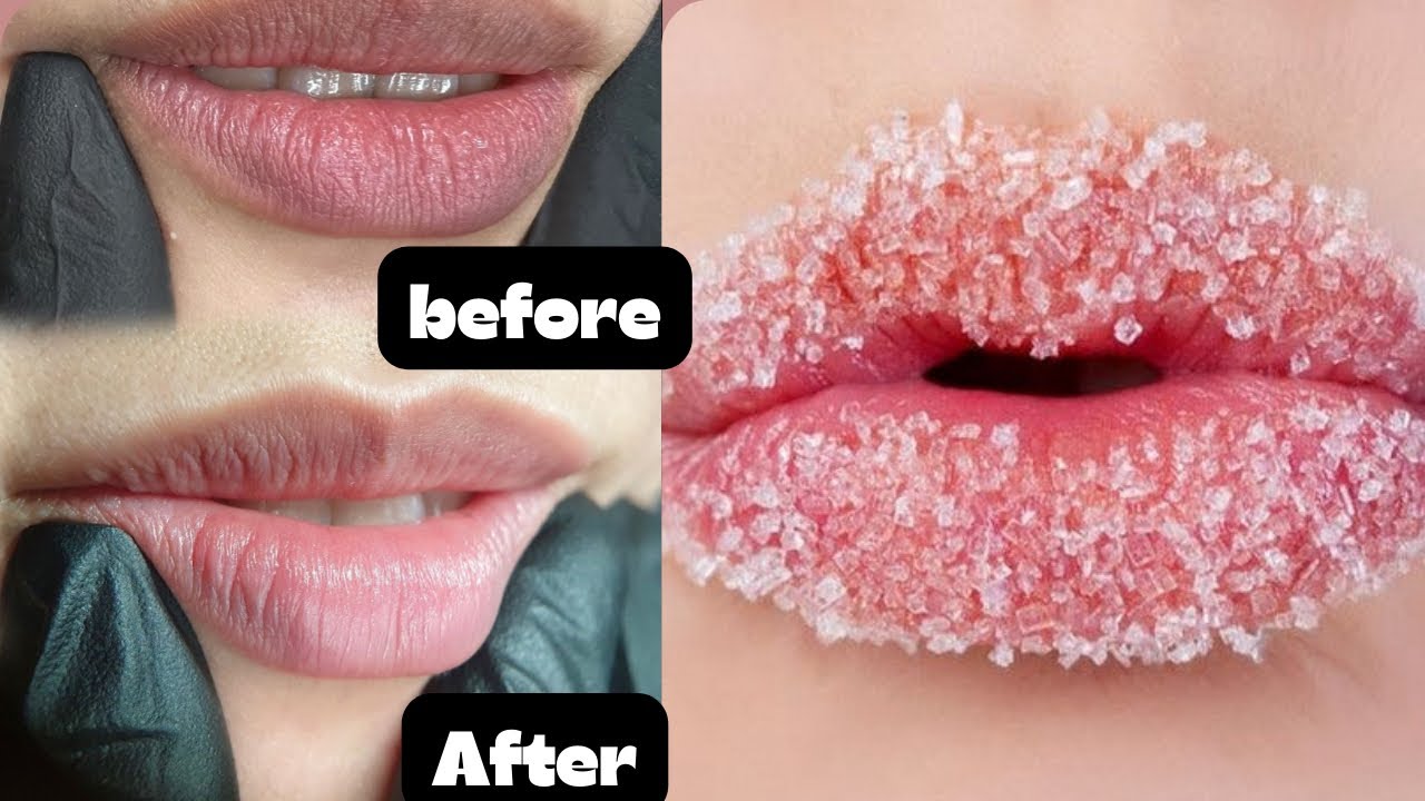 How to get pink lips naturally at home | get rid of chapped lips ...