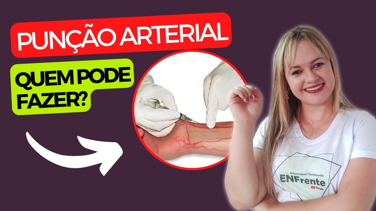 PUNÇÃO ARTERIAL PARA GASOMETRIA OU MONITORIZAÇÃO DA PA INVASIVA: QUEM ...