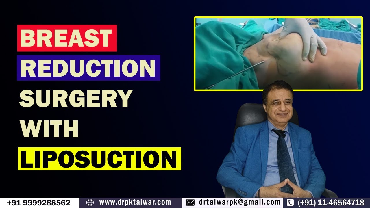 Breast Reduction Surgery with Liposuction, Reduce Breast Size with ...