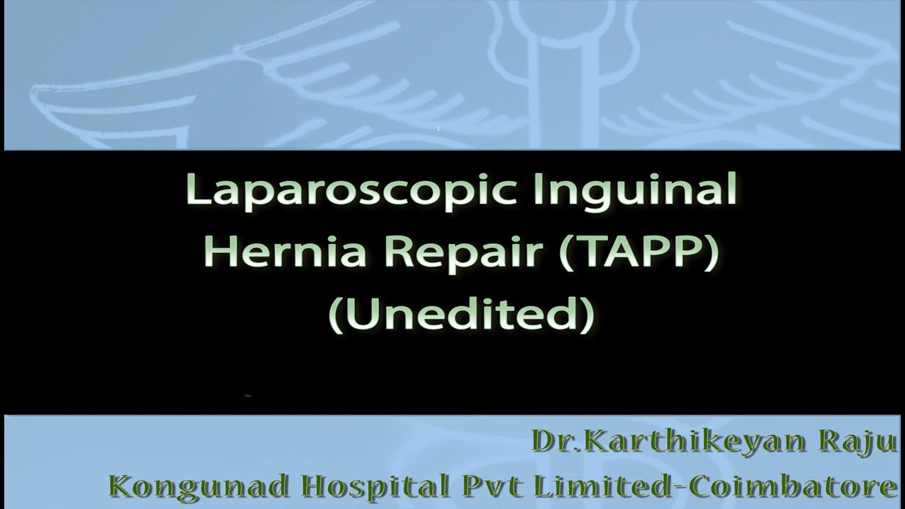 Laparoscopic TAPP Large Inguinal Hernia (Unedited) HD - YouTube