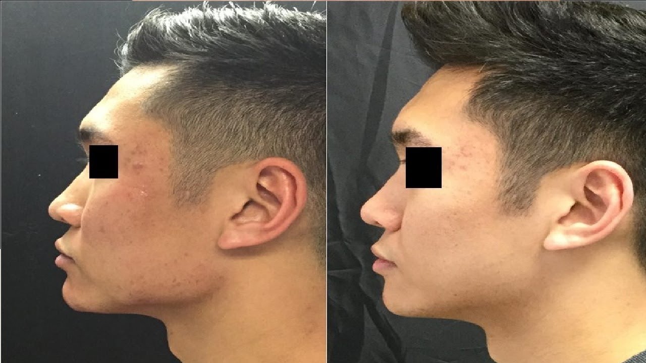 how to get the best cheekbones - YouTube