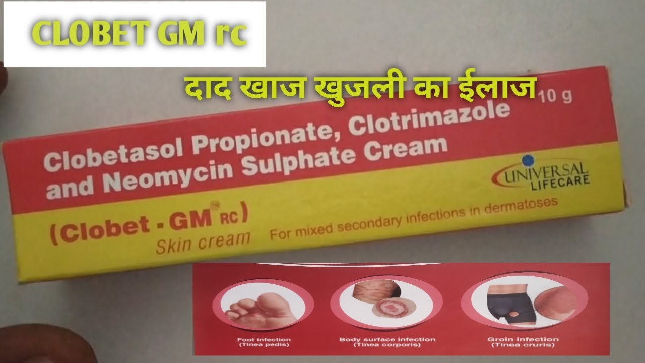 clobet gm rc Clobet GM RC Skin Cream review क्लोबेट जीएम क्रीम clobet ...