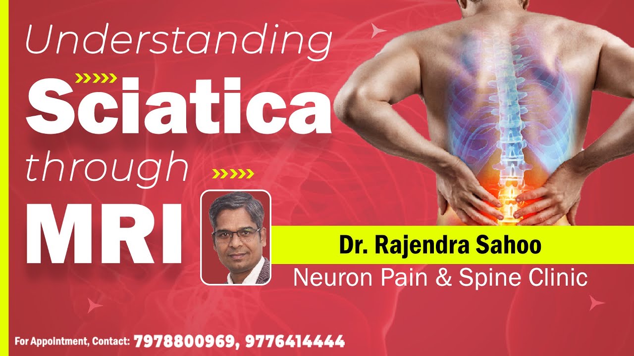 Understanding Sciatica Through MRI || Fix Lower Back Pain || Dr ...