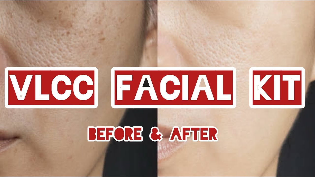 VLCC facial kit | Skin care at home | Before & After facial | Prachi ...